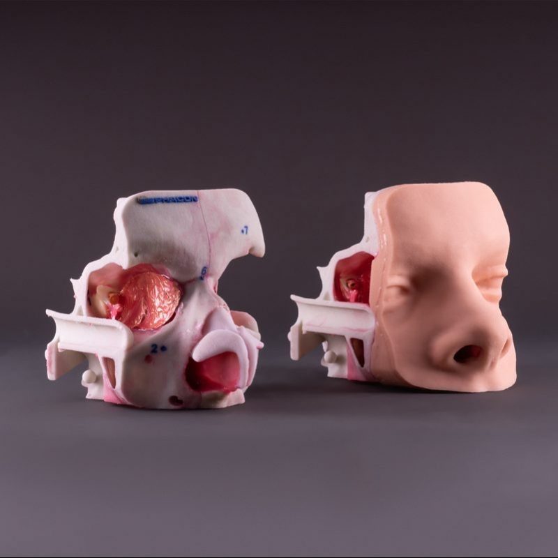 PHACON Sinus Patient “Meyer” – 40 years old – regular anatomy – Phacon